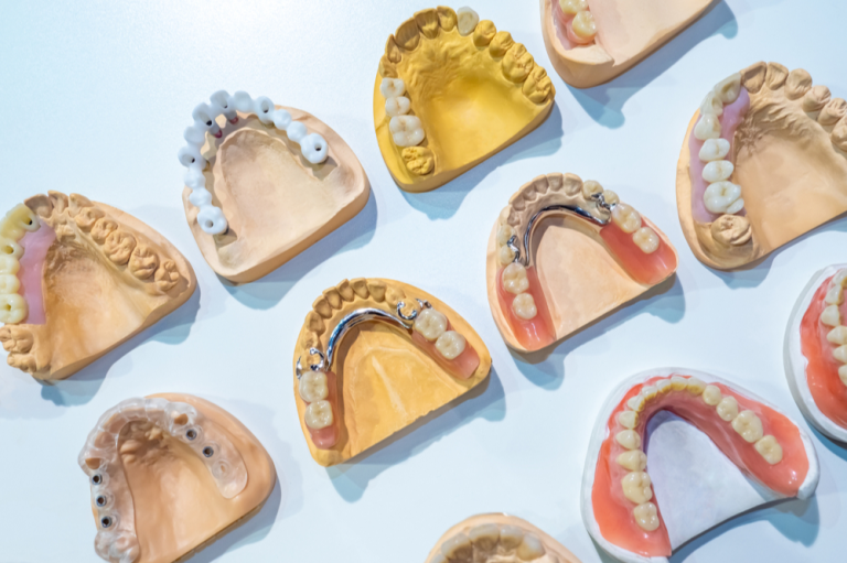 Different Types of Dentures and Their Uses and Benefits